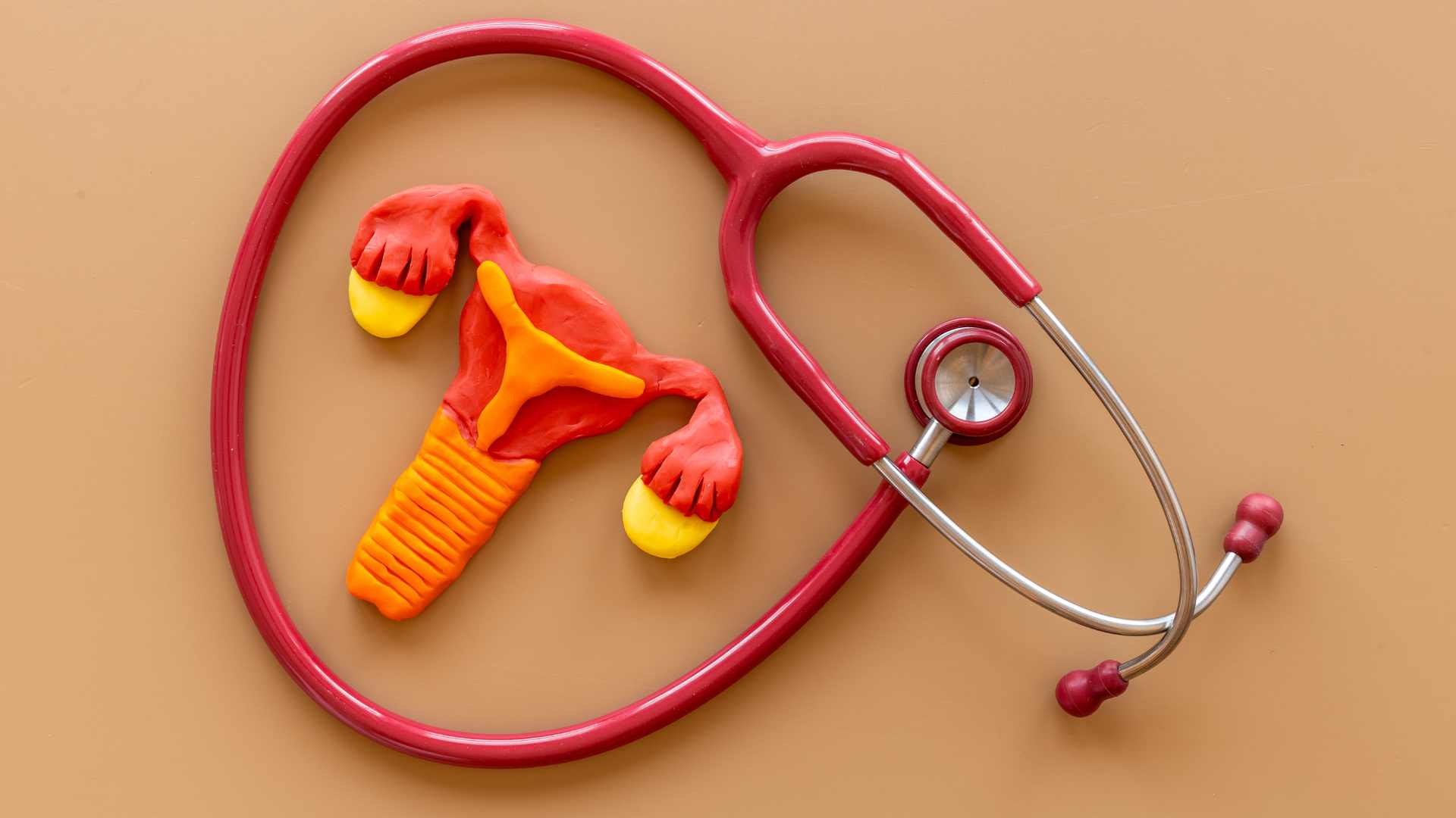 Miomatosis Uterina: Causas, Síntomas y Tratamiento